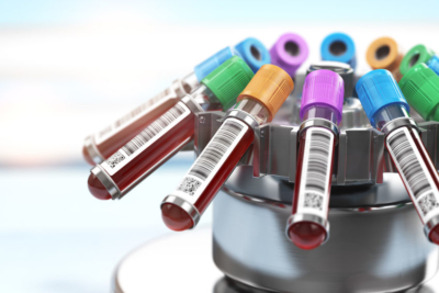 Fertility Evaluation In Women: What Blood Tests Are Done In An ...