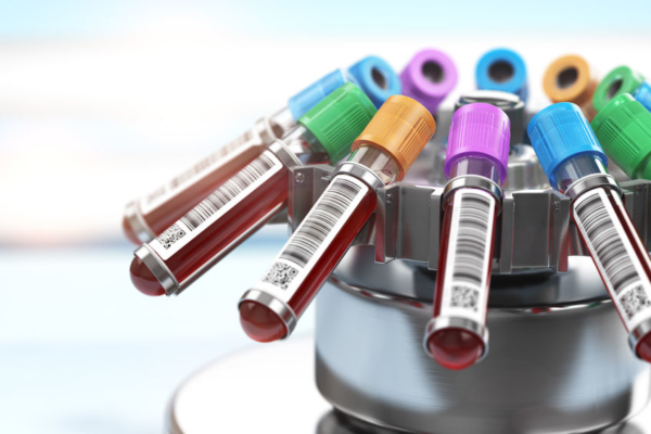 Fertility Evaluation In Women: What Blood Tests Are Done In An ...